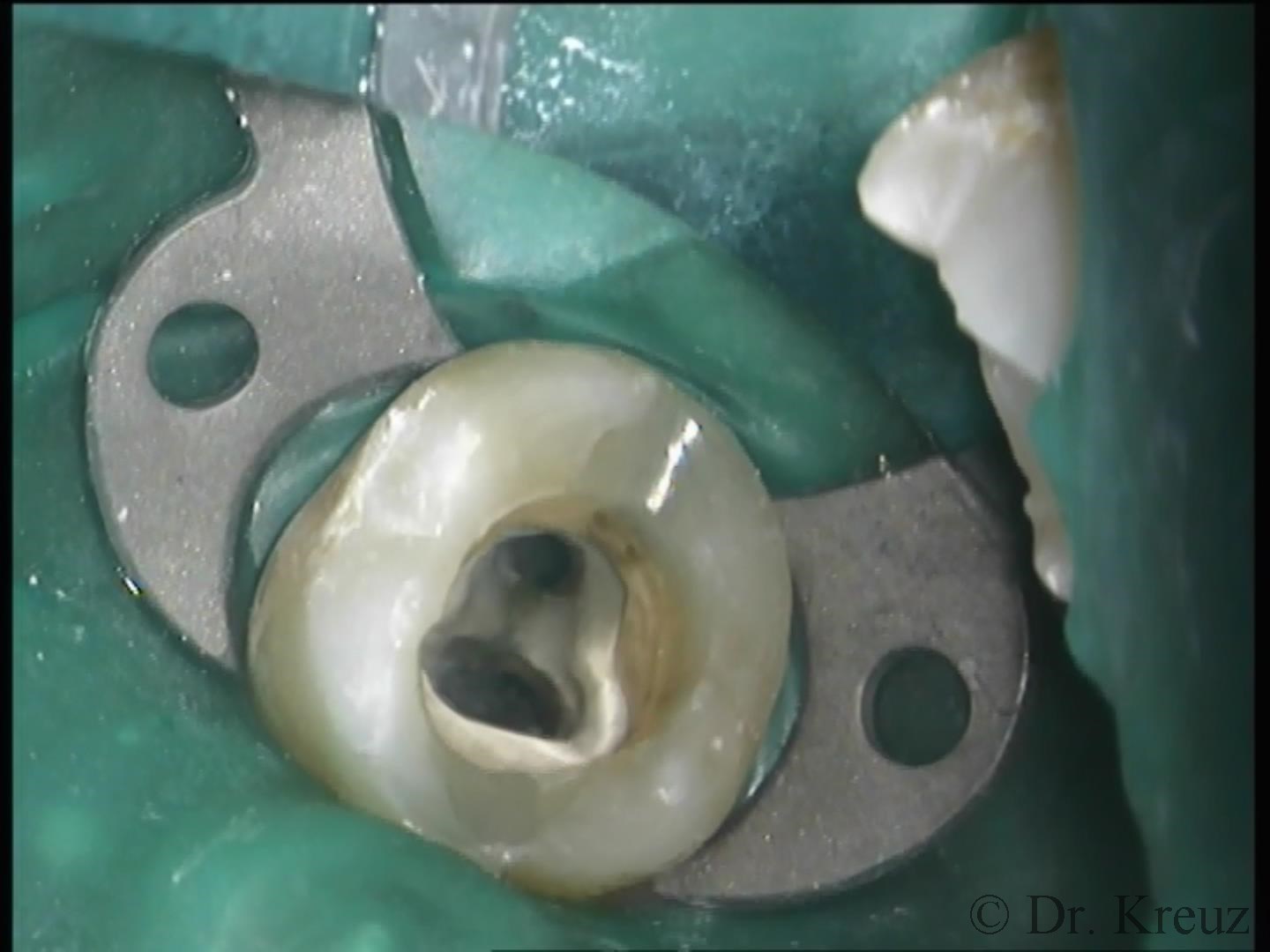 Praxis Dr. Kreuz - Kofferdam